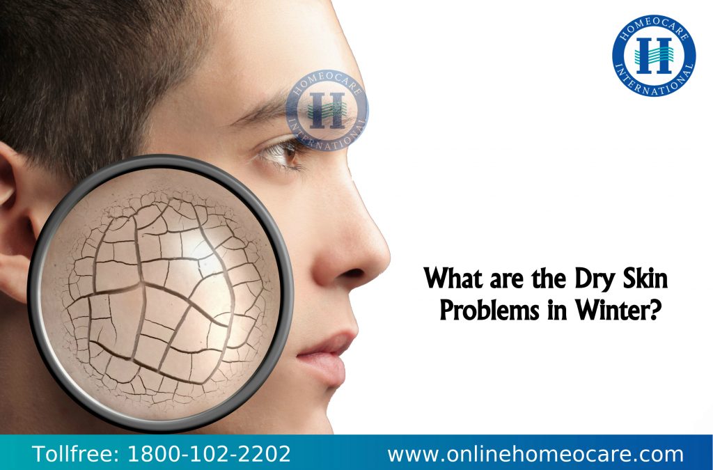 Dry Skin Rashes in Winter – Causes and Treatment – Online Homeocare